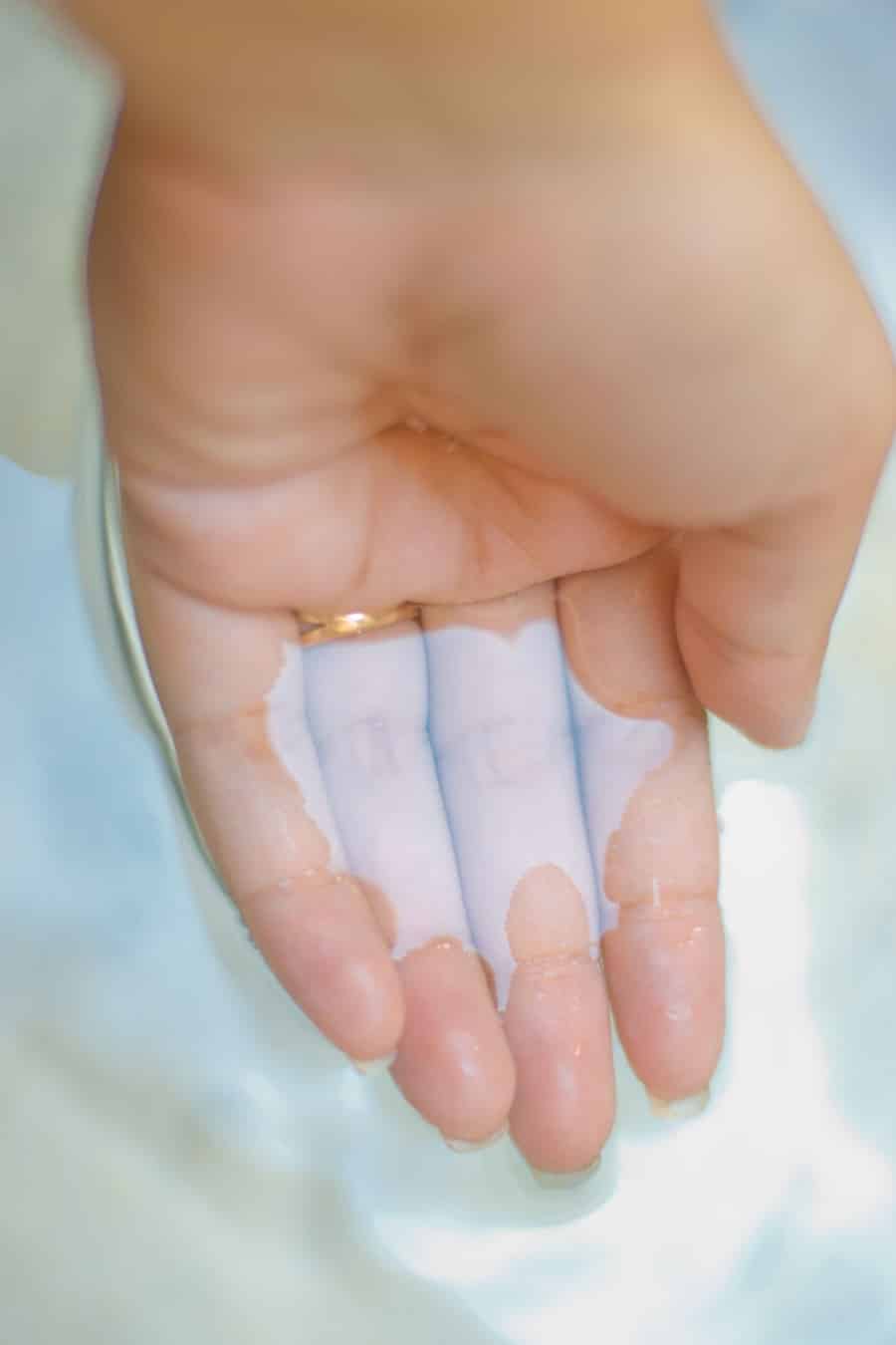 The Future of Wearable Patches for Continuous Glucose Monitoring